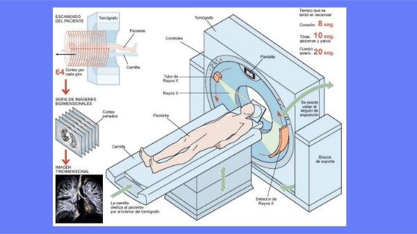 Partes del Tomógrafo 2