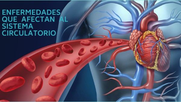ENFERMEDADES QUE AFECTAN AL SISTEMA CIRCULATORIO