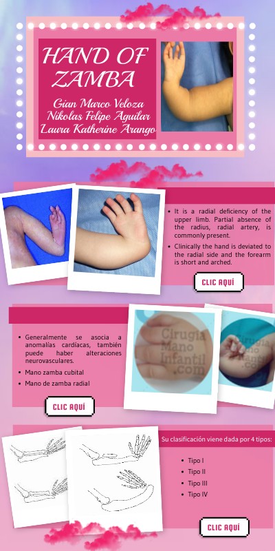 MANO DE ZAMBA by Laura Katherine Arango Fuquene on Genially