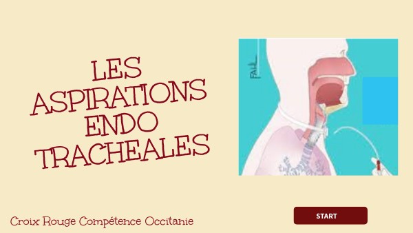 Protocole Montage Aspiration – Schéma Aspiration Endo Trachéale – BEDN