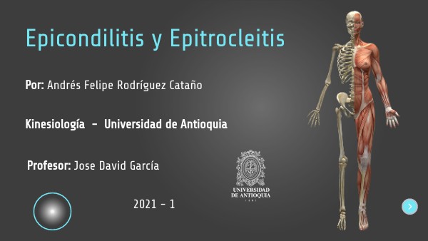 Epicondilitis y Epitrocleitis