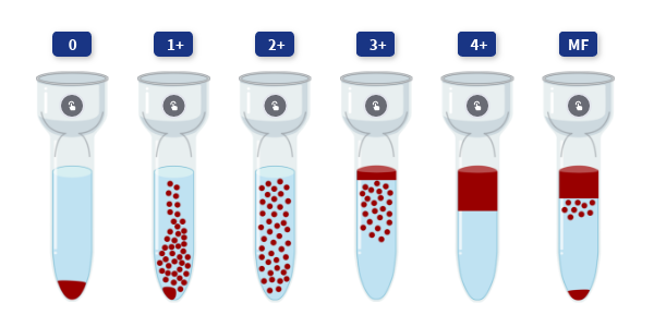 69504 Diagnostic Pathology - Column Agglutination