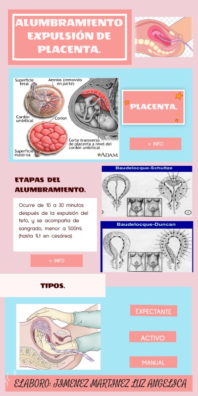 ALUMBRAMIENTO EXPULSIÓN DE PLACENTA.