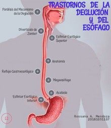 Trastornos de la Deglución y Esófago