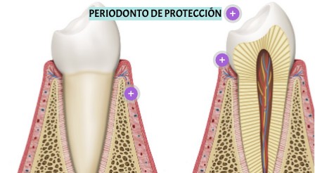 PERIODONTO DE PROTECCIÓN