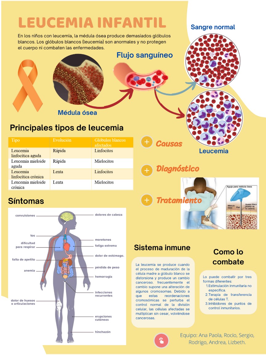 Leucemia En Los Niños – GLJY