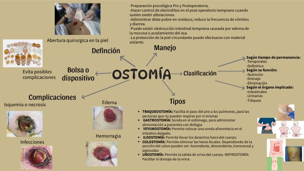 ostomia-vecl