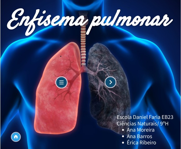 Enfisema pulmonar