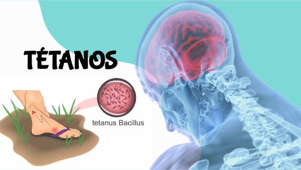 TETANOS