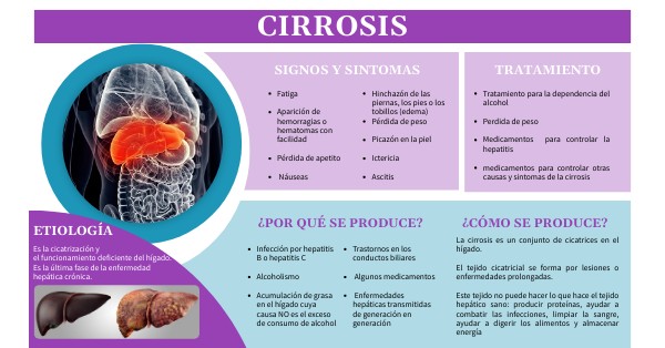 CIRROSIS