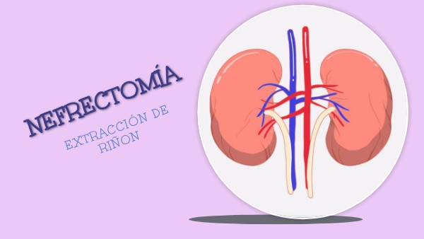PRESENTACION- NEFRECTOMIA
