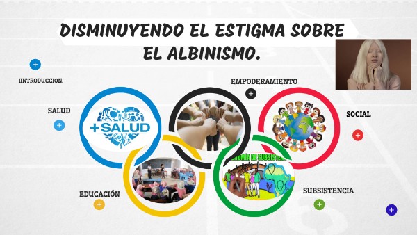 Qu Es Albinismo Su Definicin Y Significado 2020