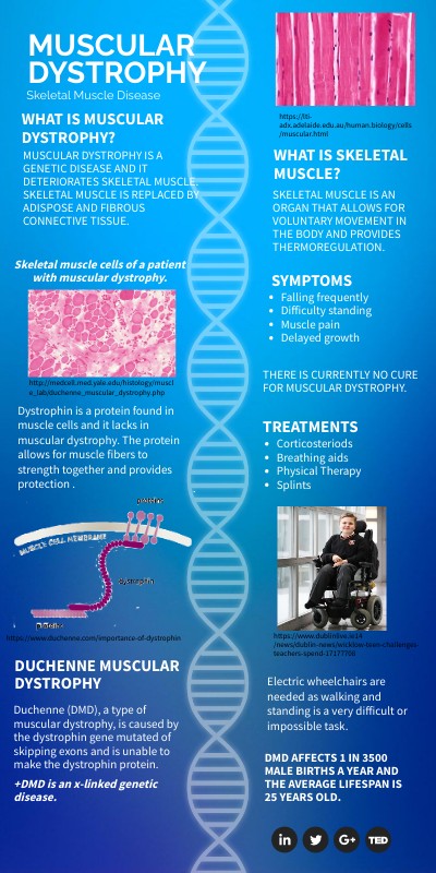 Muscular dystrophy