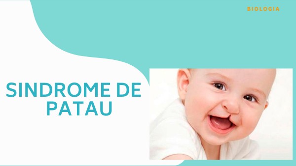 SINDROME DE PATAU