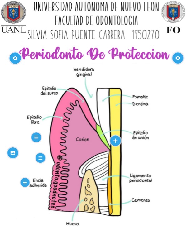 PERIODONTO DE PROTECCION