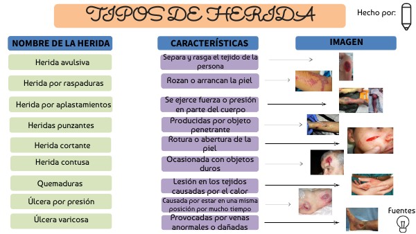 Tipos De Heridas Que Existen – Clasificacion De Las Heridas – OQFHVI