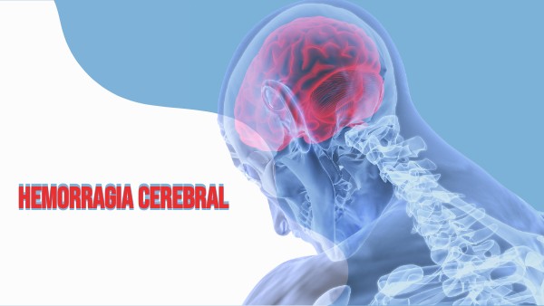 Hemorragia Cerebral