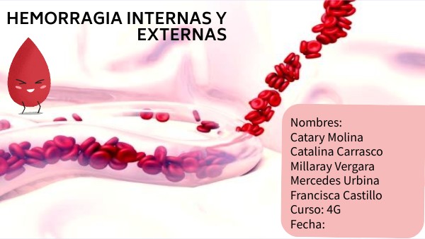 hemorragia interna y externa