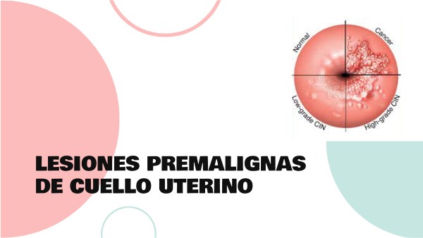 Lesiones Premalignas de Cuello Uterino