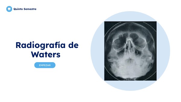 RADIOGRAFÍA DE WATERS