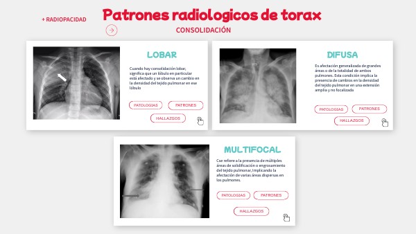 Patrones Radiologicos