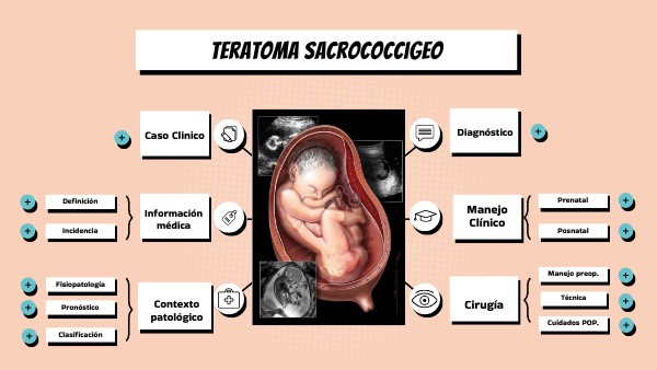 teratoma sacrococcigeo