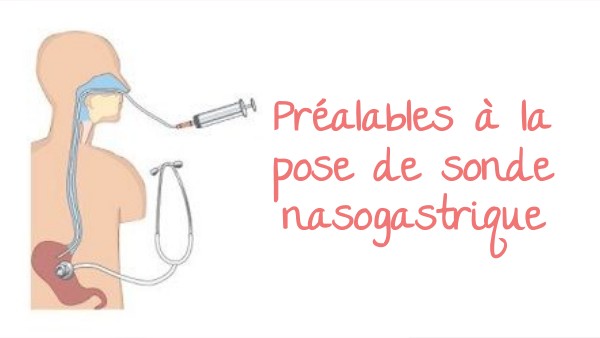 Préalables à la pose de sonde nasogastrique