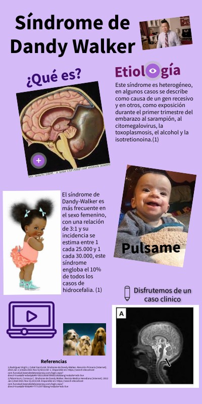 SINDROME DE DANDY WALKER