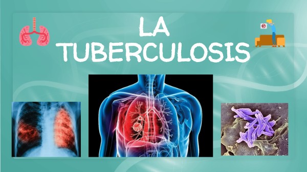 PRESENTACIÓN TUBERCULOSIS