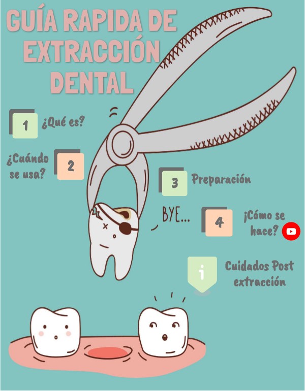 Guía Rapida de extración dental simple