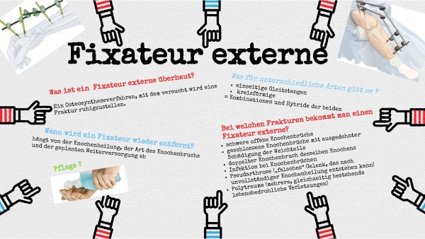 Fixateur externe