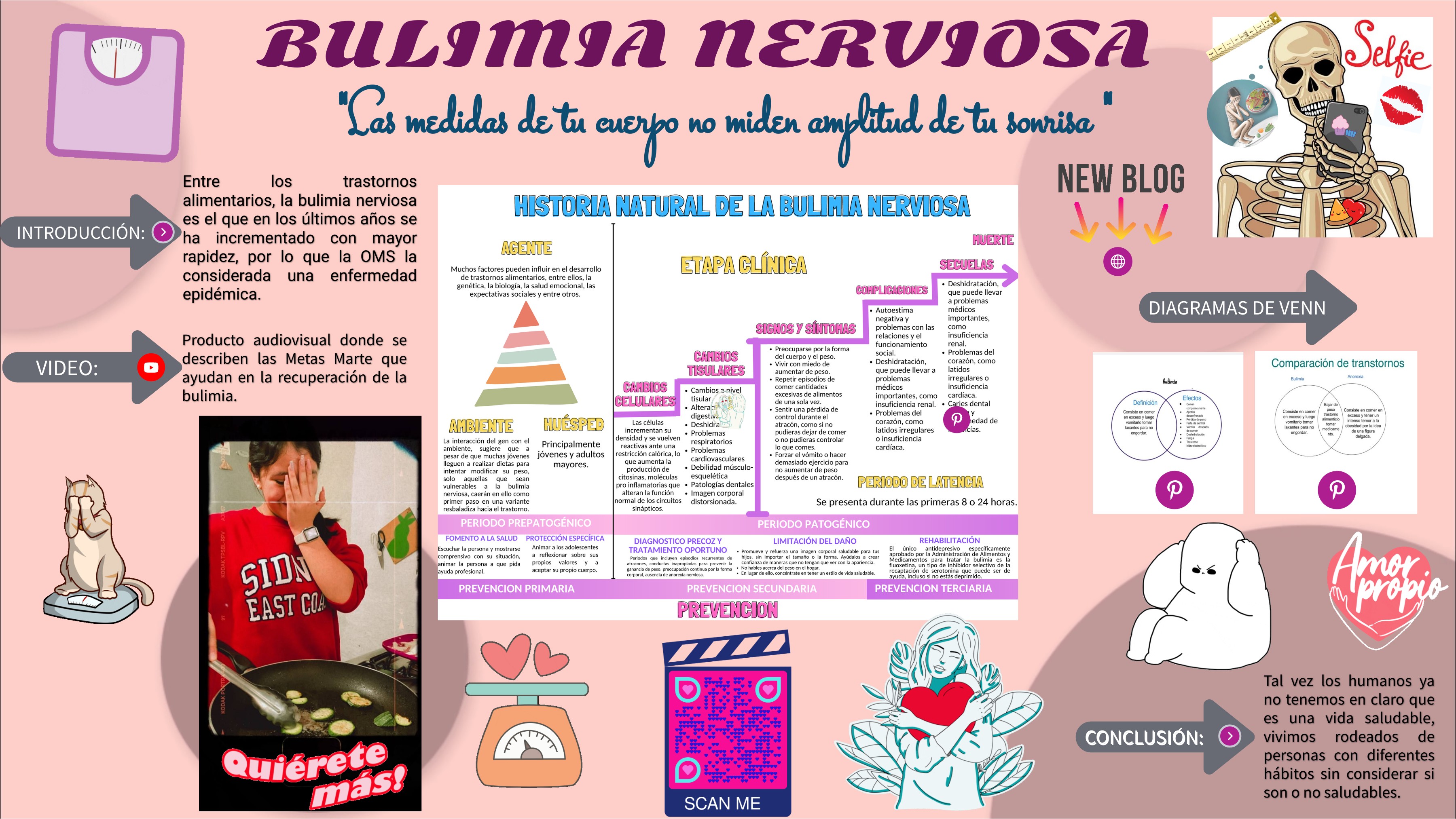 BULIMIA NERVIOSA