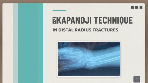 Distal Radius Fracture Kapandji Intrafocal Pinning Technique