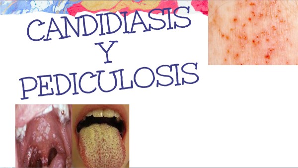 CANDIDIASIS