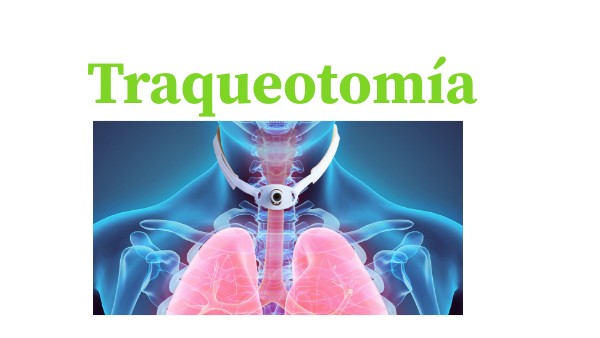 traqueostomia