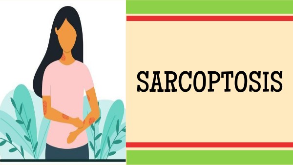 Sarcoptosis