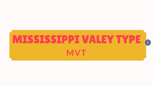 MVT