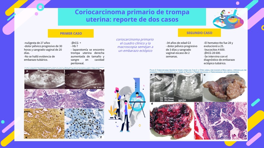 Coriocarcinoma primario de trompa uterina: reporte de dos casos