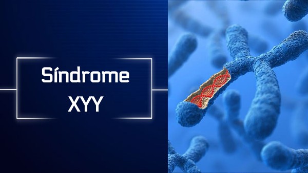 Síndrome XYY