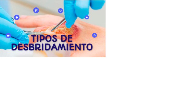 TIPOS DE DESBRIDAMIENTO