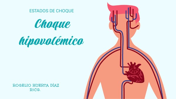 Choque Hipovolémico R1CG