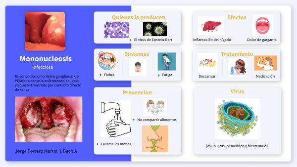 Mononucleosis infecciosa