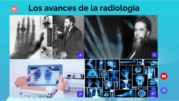 Los avances en la radiologia