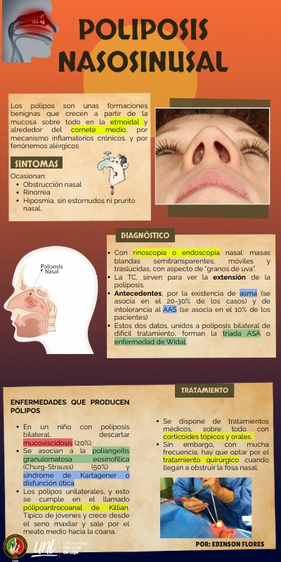 POLIPOSIS NASAL