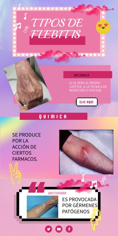 TIPOS DE FLEBITIS