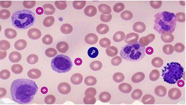 Leucócitos no sangue.