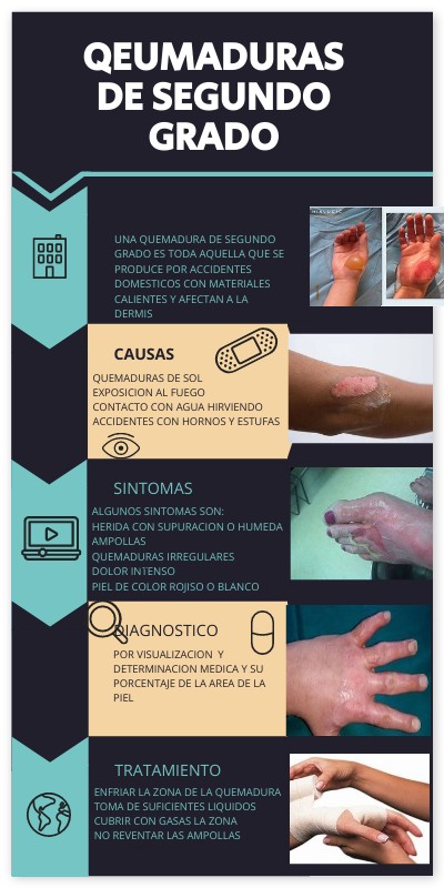 QUEMADURAS 2DO GRADO