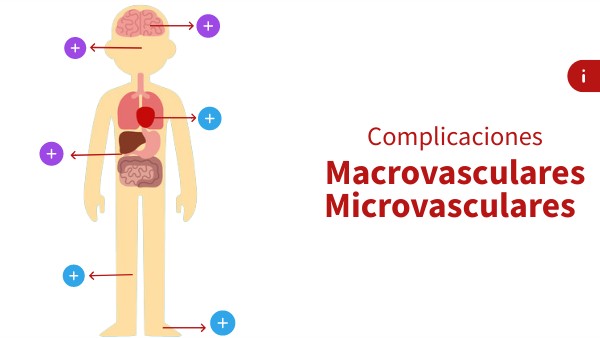 Complicaciones macro y microvasculares