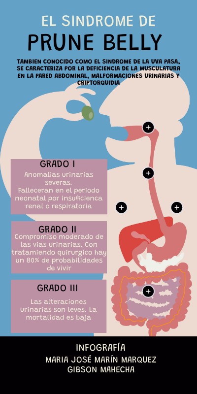SINDROME DE PRUNE BELLY