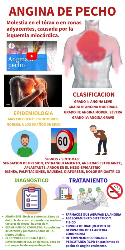 ANGINA DE PECHO 1967400